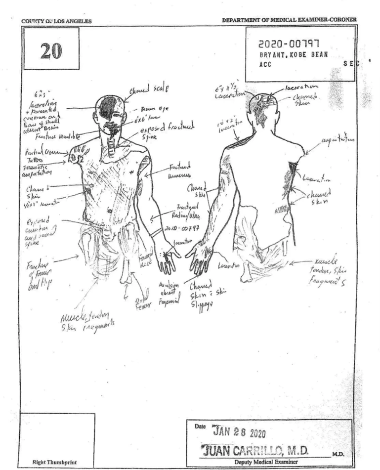 Photos of Kobe Bryant Fatal Helicopter Crash Were Shared Just 'For A ...